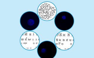 KROHEM – Hrvatska kooperativna grupa za hematološke bolesti